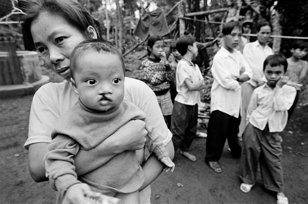 Agent Orange: Collateral Damage in Vietnam | Magnum Photos