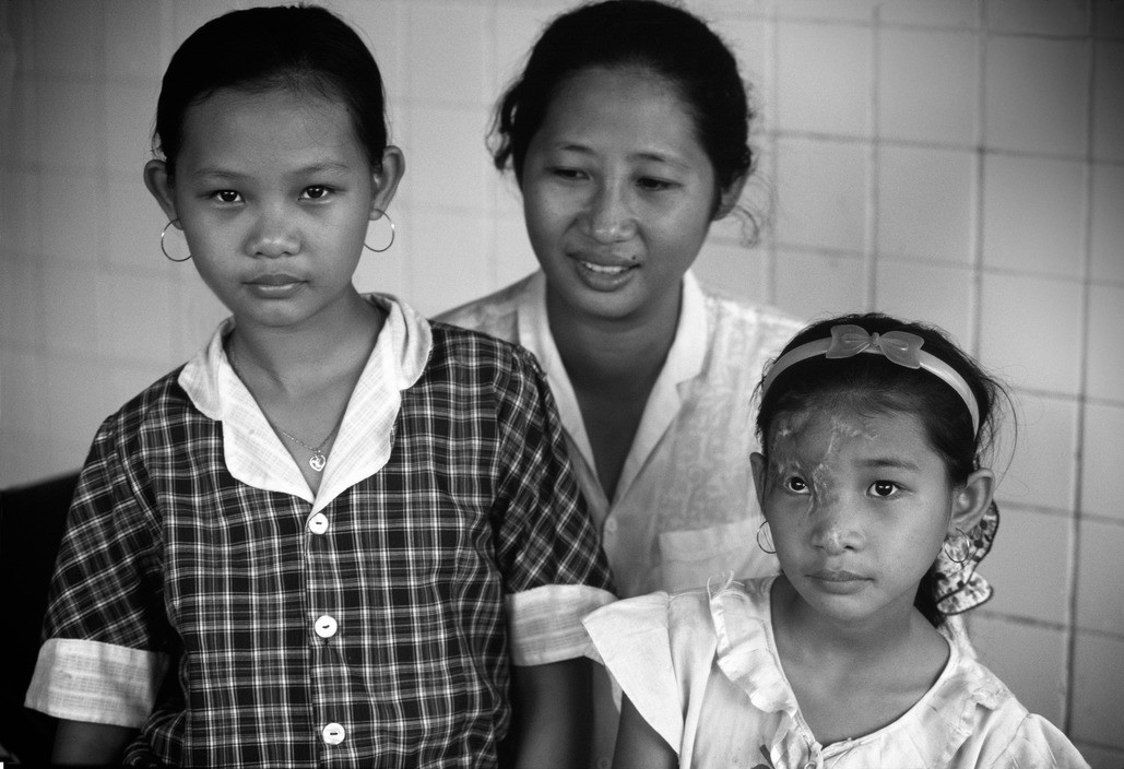 Agent Orange: Collateral Damage in Vietnam | Magnum Photos