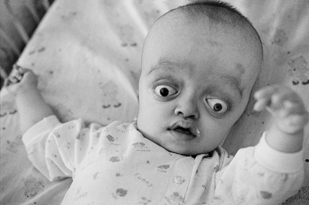 Agent Orange: Collateral Damage in Vietnam | Magnum Photos